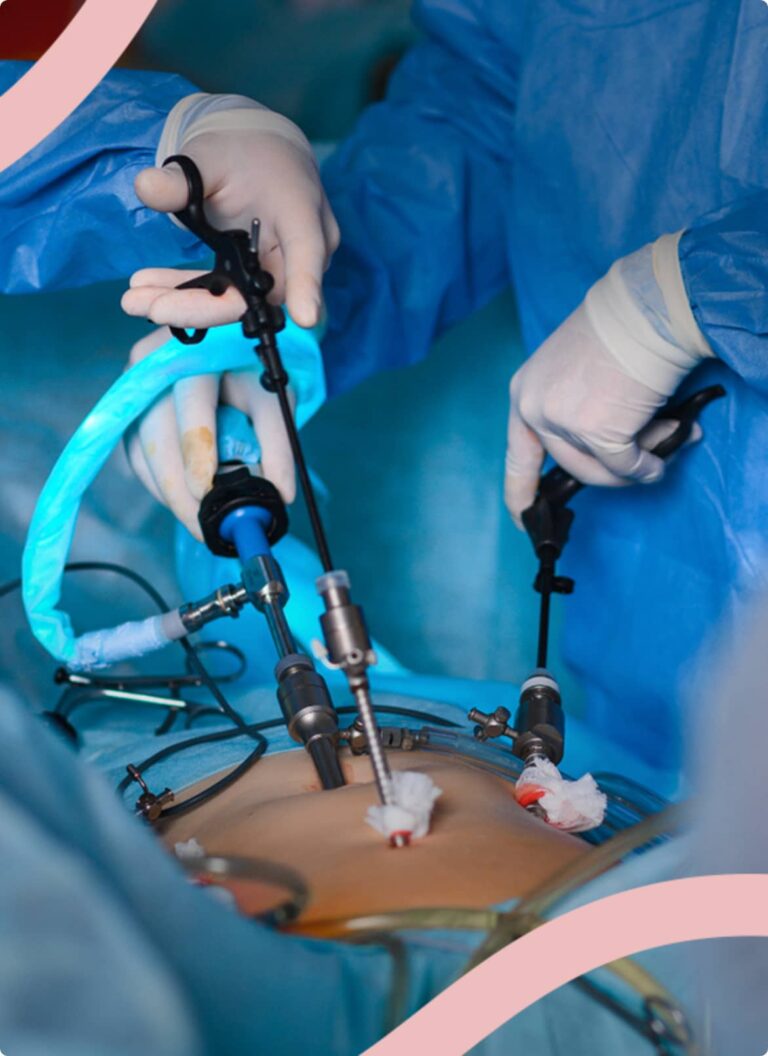 Cirugía de Hernia Hiatal y Reflujo – Gastrosud